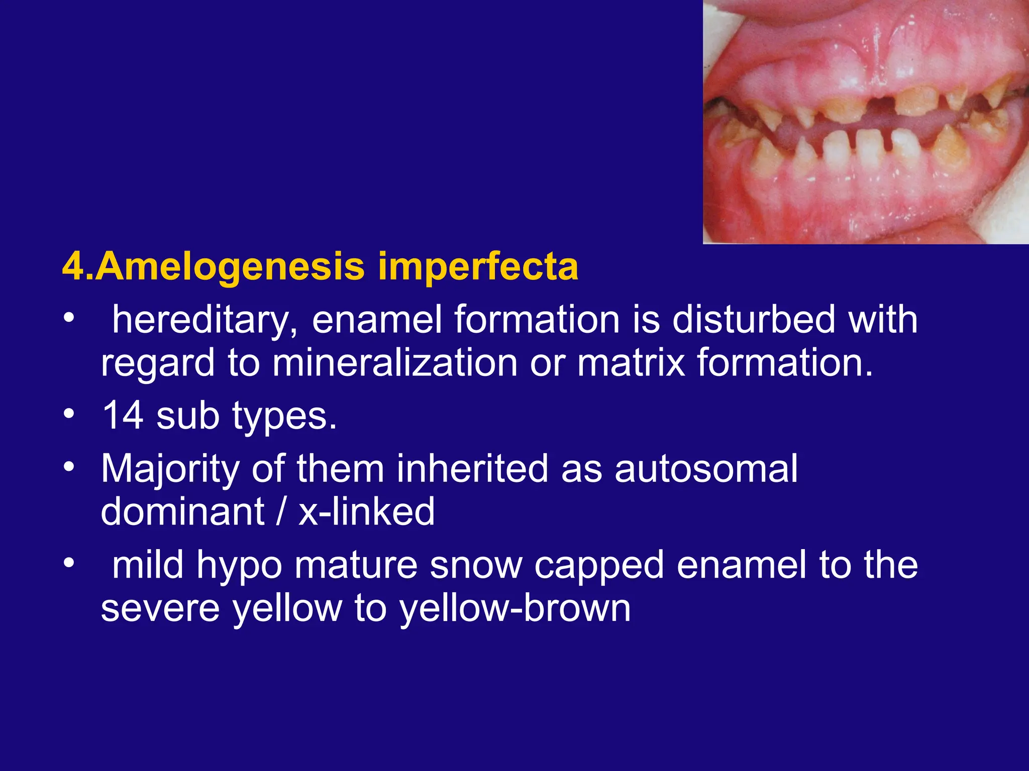 Bleaching materials and techniques, complications | PPT