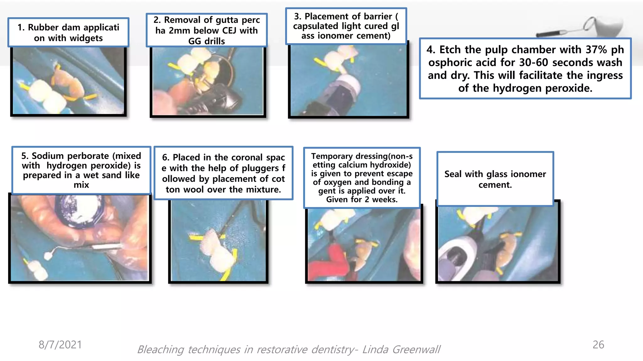 Bleaching & Restorations of discolored teeth in Pediatric Dentistry | PPTX