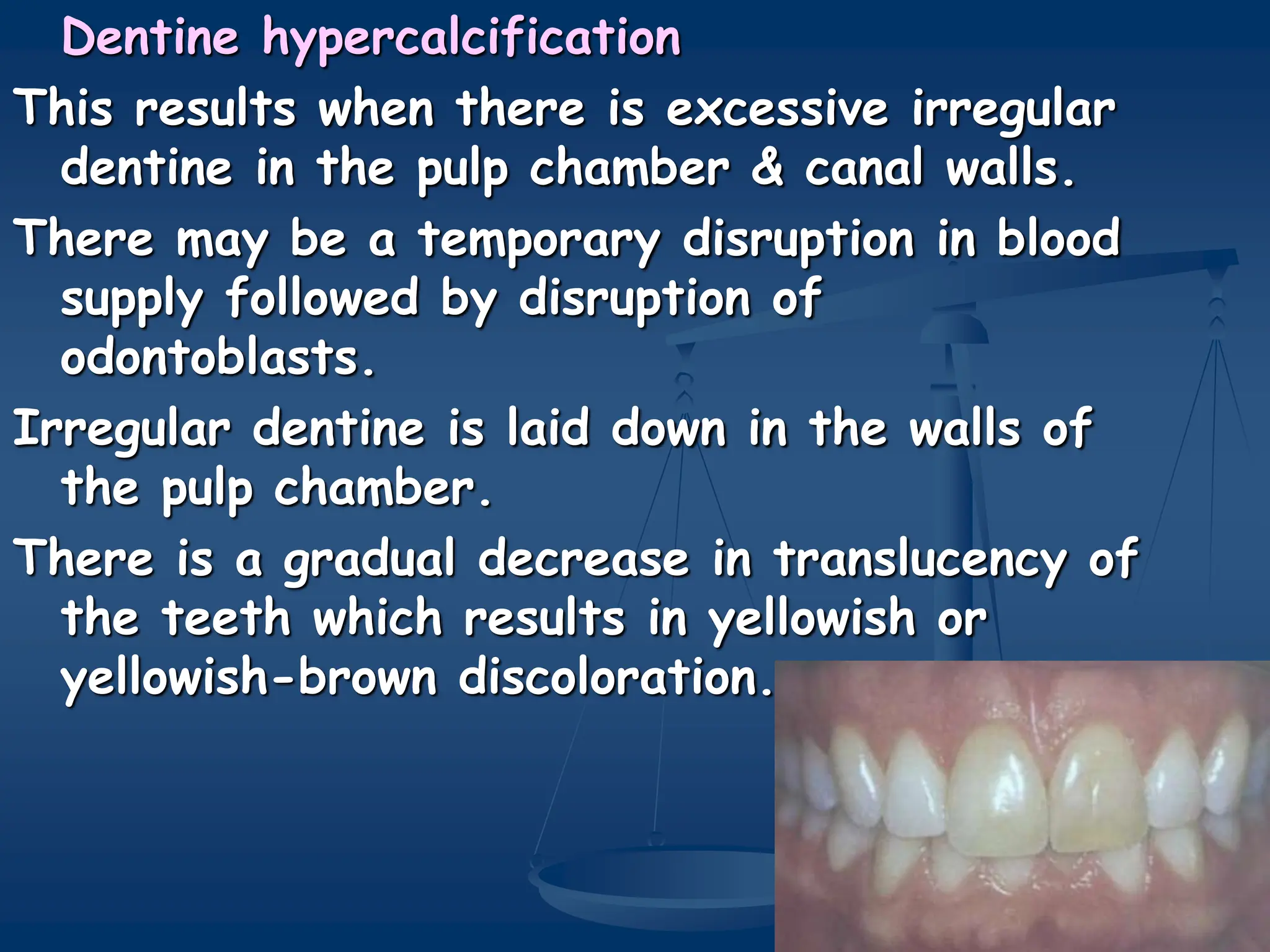 BLEACHING TECHNIQUES IN RESTORATIVE DENTISTRY.pptx Whitening of root ...