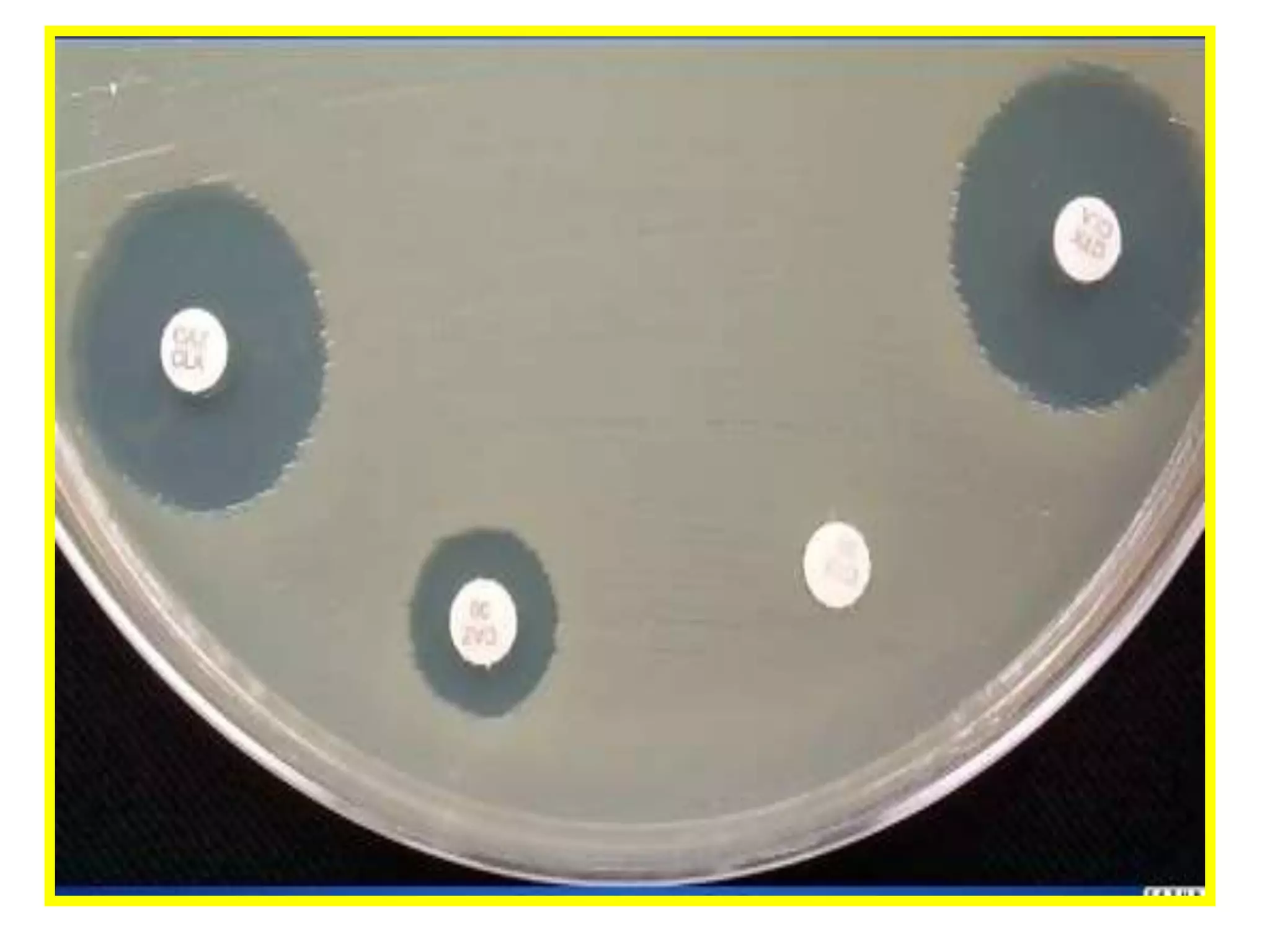 Antibiótico en bacterias con betalactamasa de espectro extendido (BLEE ...