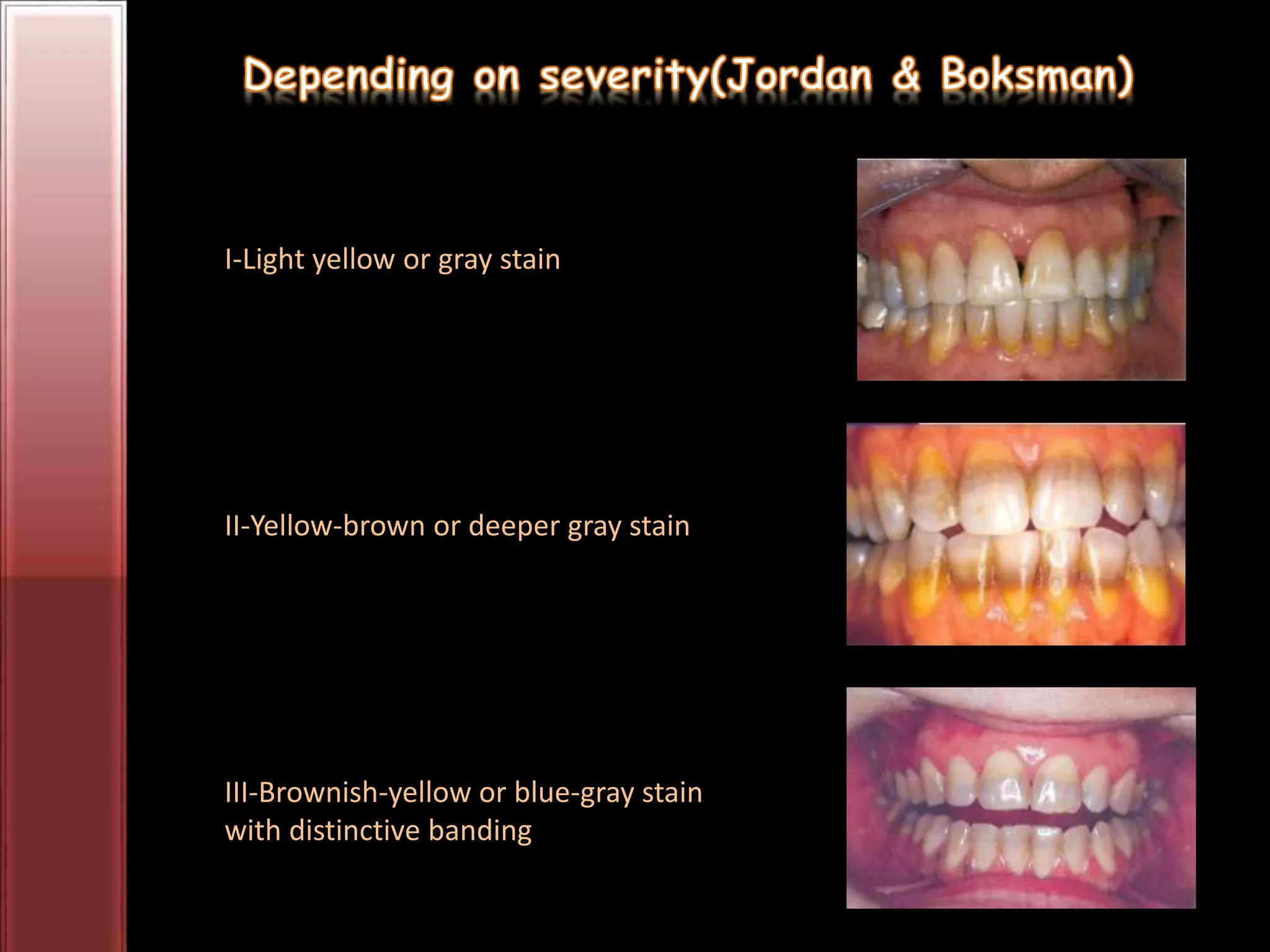 Bleaching | PPTX | Dental Health | Diseases and Conditions