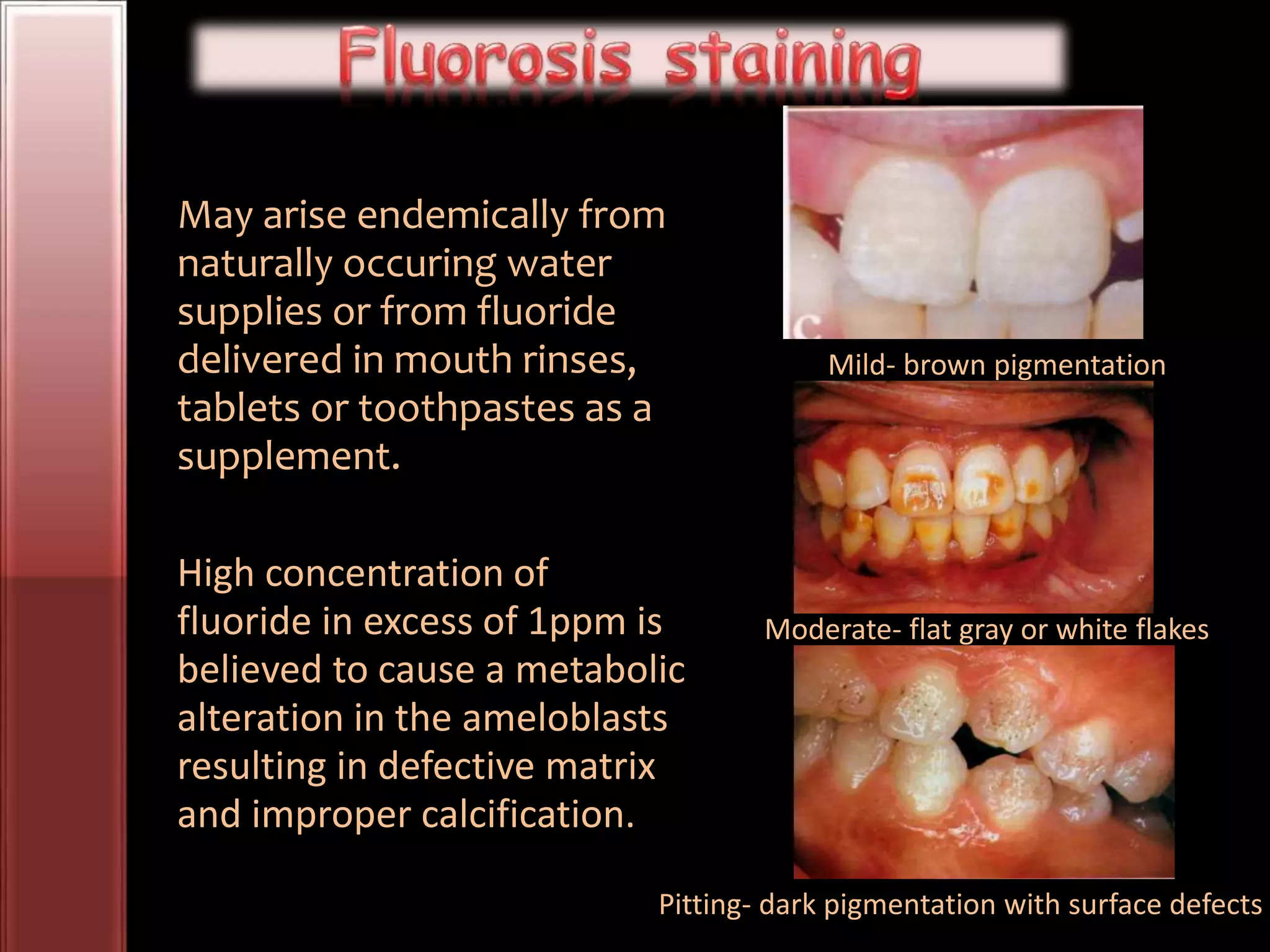 Bleaching | PPTX | Dental Health | Diseases and Conditions