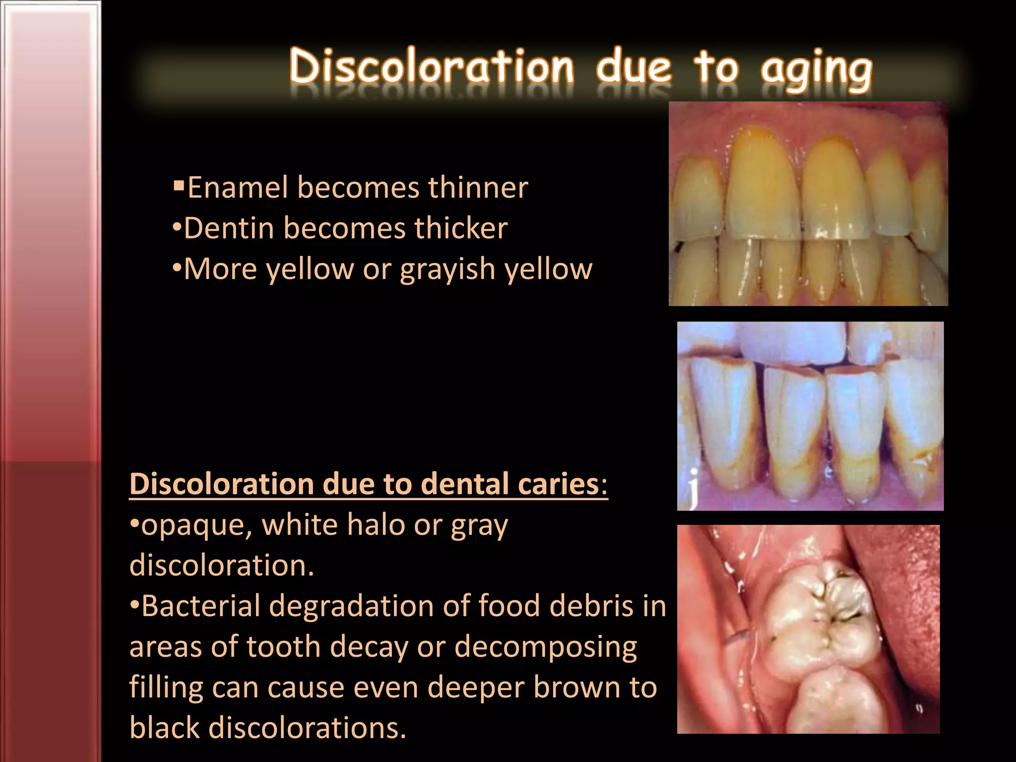 Bleaching | PPTX | Dental Health | Diseases and Conditions