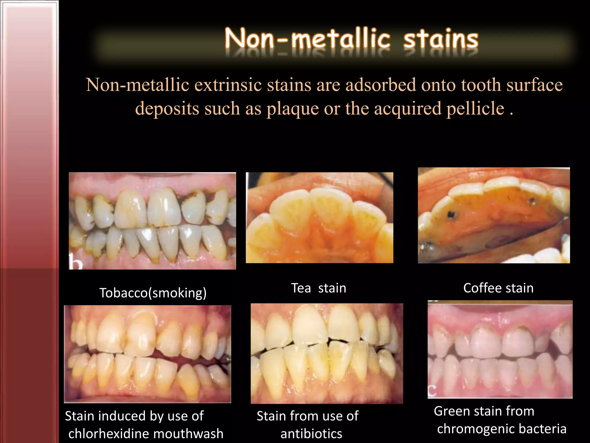 Bleaching | PPTX | Dental Health | Diseases and Conditions