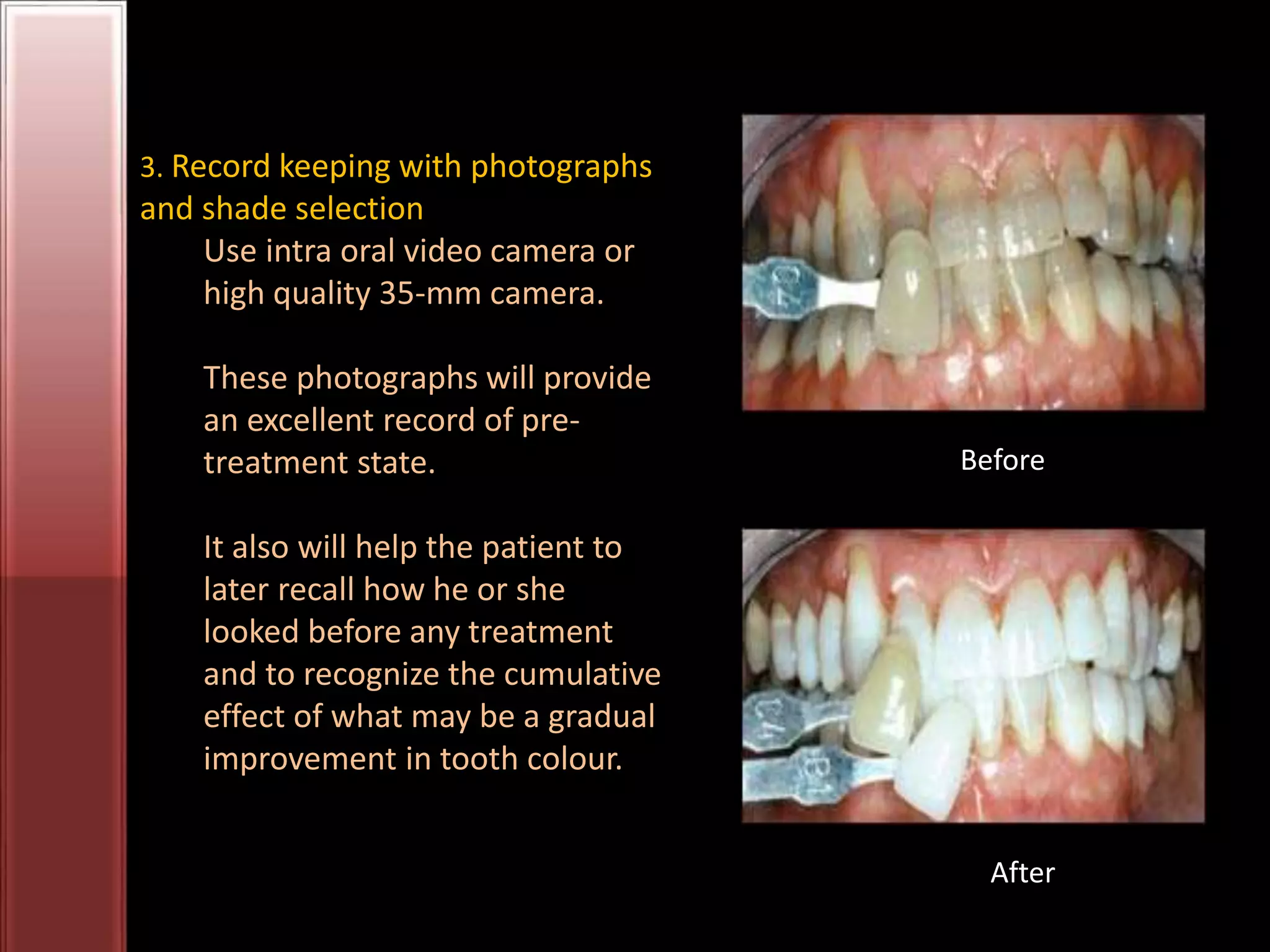 Bleaching | PPTX | Dental Health | Diseases and Conditions