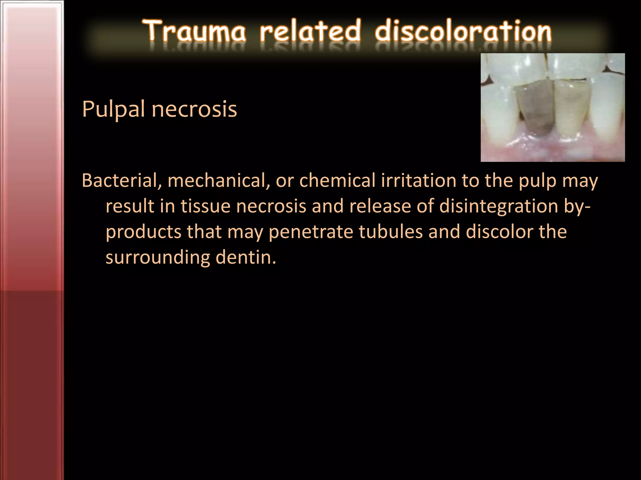 Bleaching | PPTX | Dental Health | Diseases and Conditions