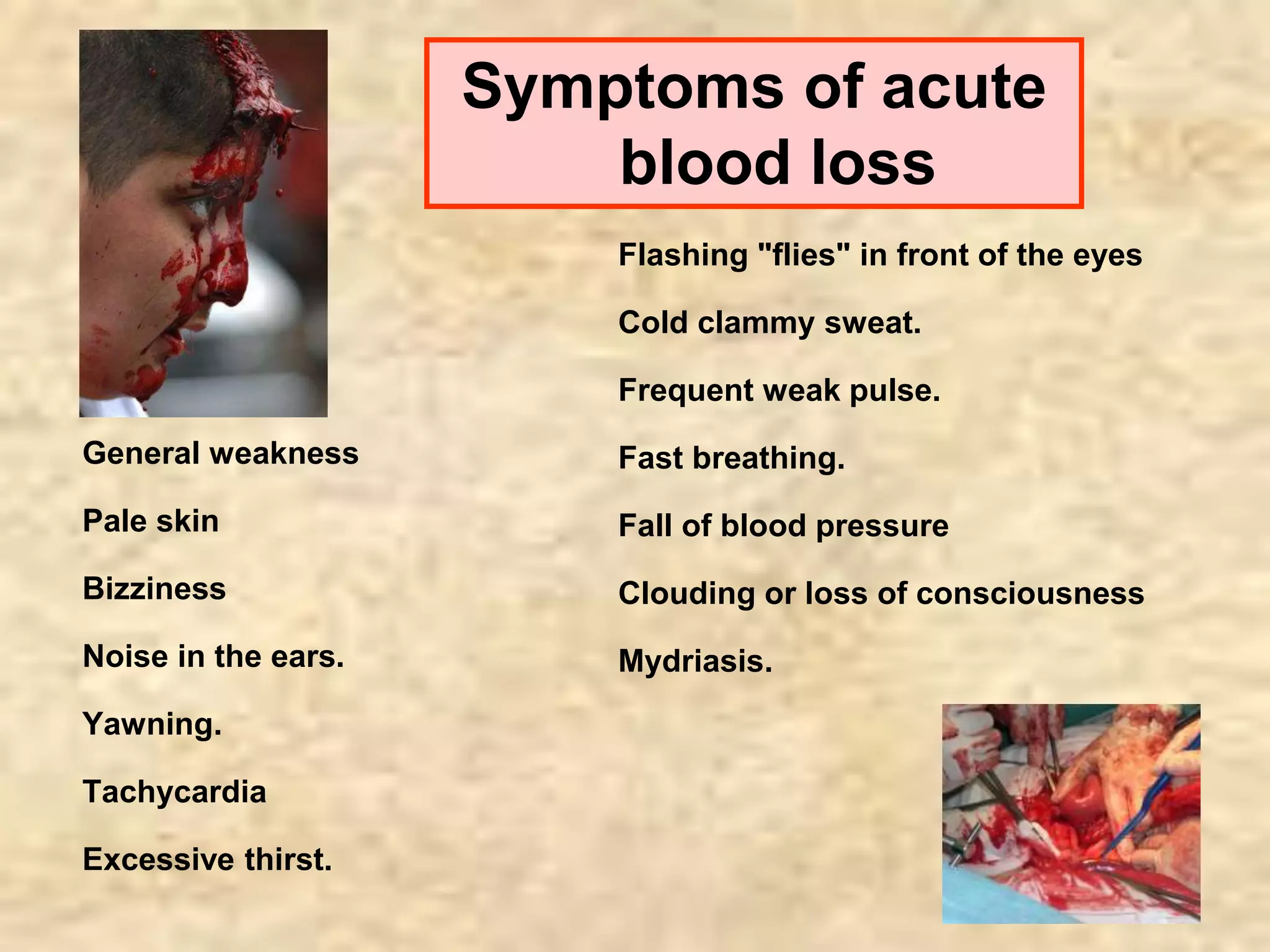 Bleeding. blood loss. bleeding compensation in eliminating the ...