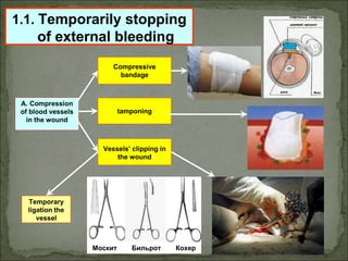 Bleeding. blood loss. bleeding compensation in eliminating the ...