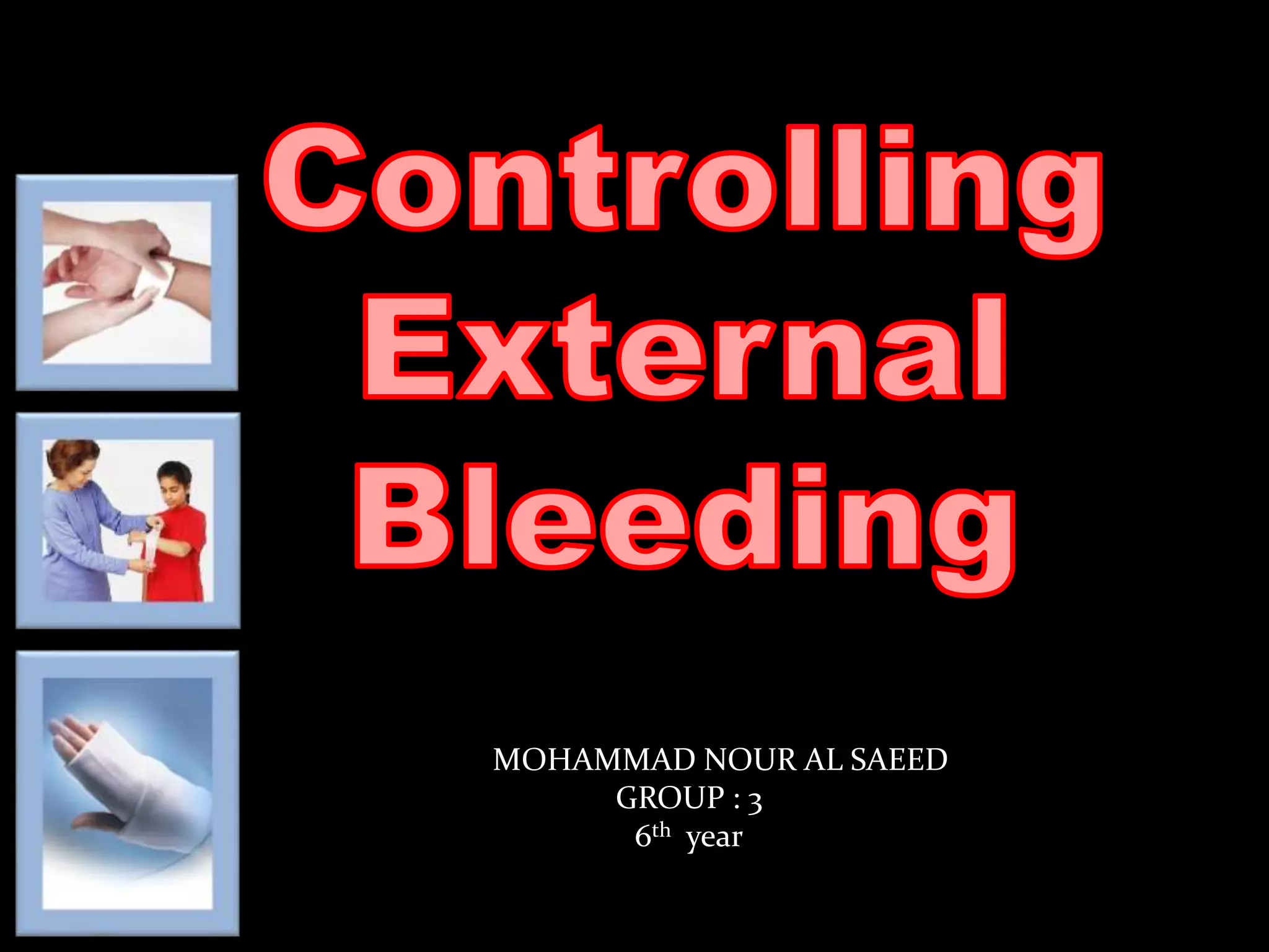 Controlling External Bleeding | PPTX