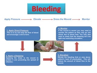 Controlling External Bleeding | PPTX