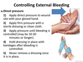 Controlling External Bleeding | PPTX