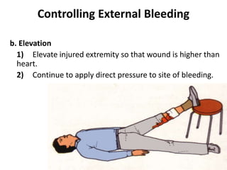 Controlling External Bleeding | PPTX