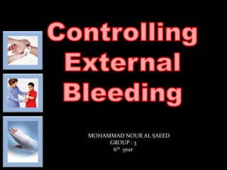 External Bleeding Treatment