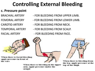 External Bleeding Treatment