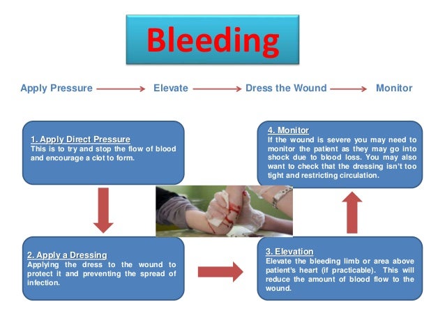Controlling External Bleeding