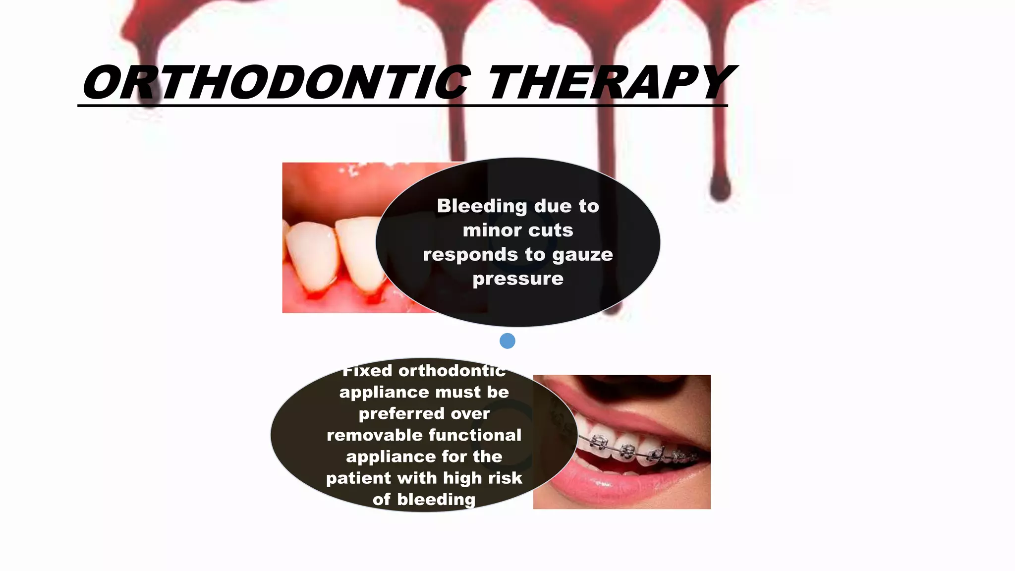 dental management of Bleeding disorders | PPTX