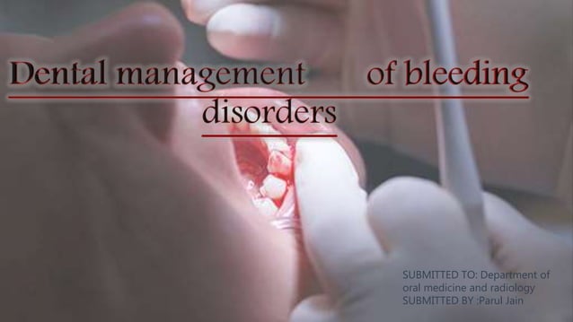dental management of Bleeding disorders | PPTX
