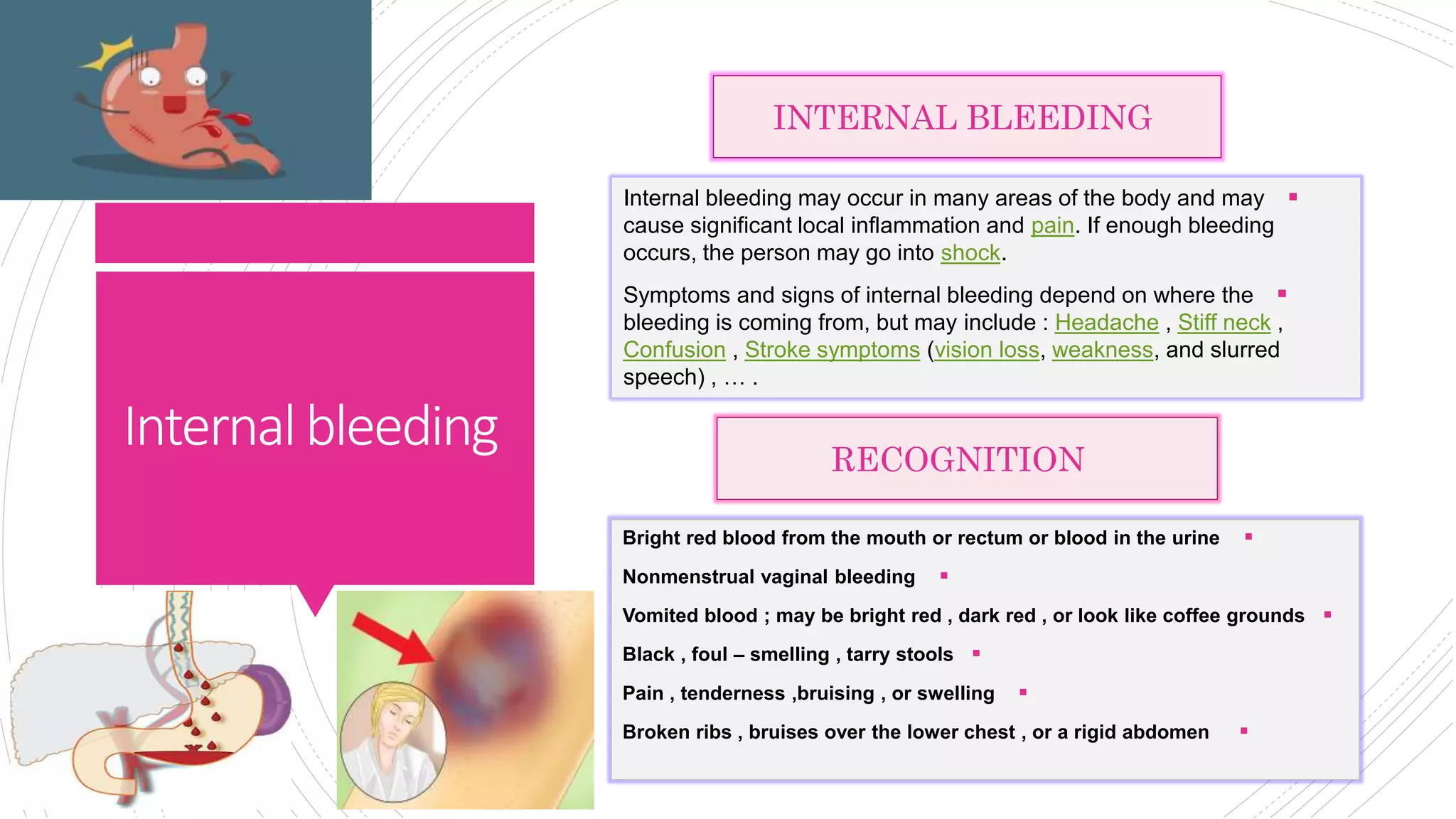 Bleeding | PPTX | First Aid | Injuries