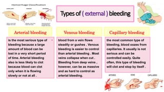 Bleeding | PPTX