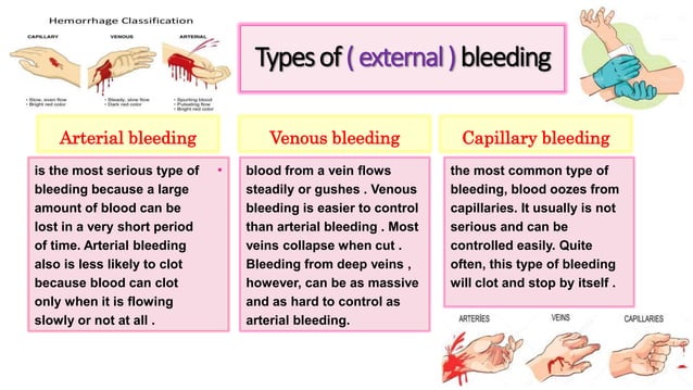 Bleeding | PPTX | First Aid | Injuries
