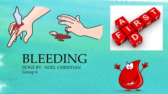 Bleeding | PPTX | First Aid | Injuries