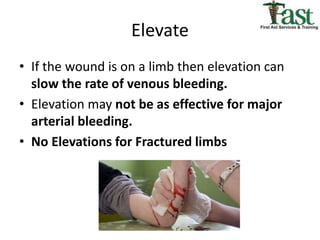 Bleeding | PPT