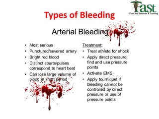 Bleeding | PPT