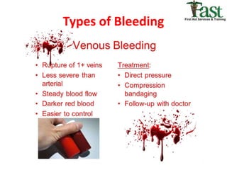 Bleeding | PPT