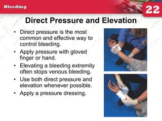 bleeding.ppt