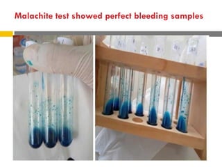 bleeding in slaughtered animals and its effect in meat quality.pptx