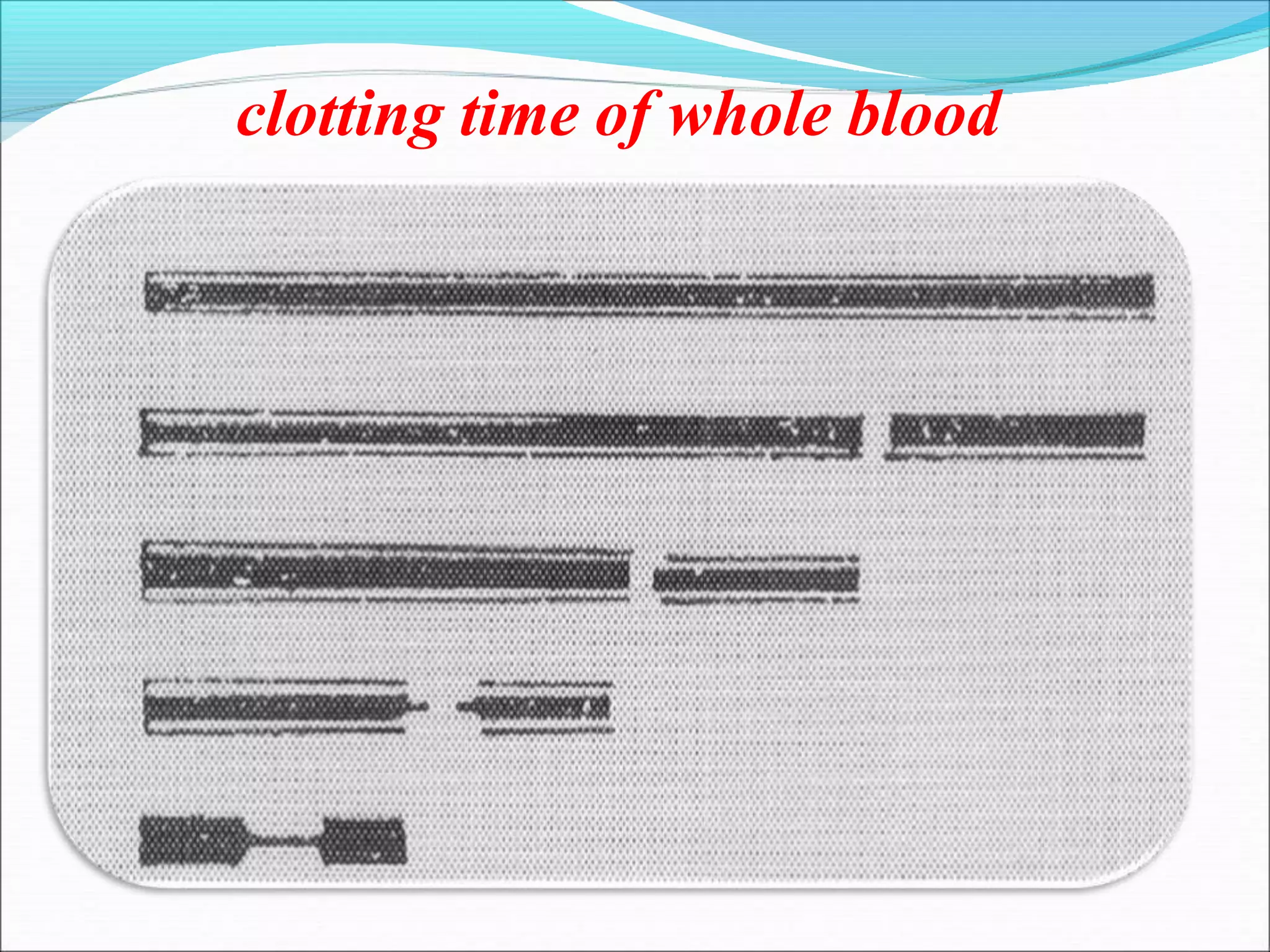bleeding-timeclotting-time-pt-and-ptt-130504122408-phpapp01.pptx