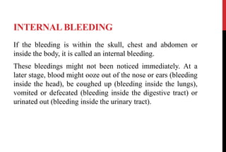 BLEEDING (2).pptx | First Aid | Injuries