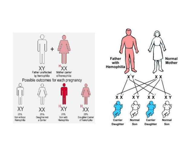 Bleeding and clotting disorders in children | PPTX | Blood Disorders ...