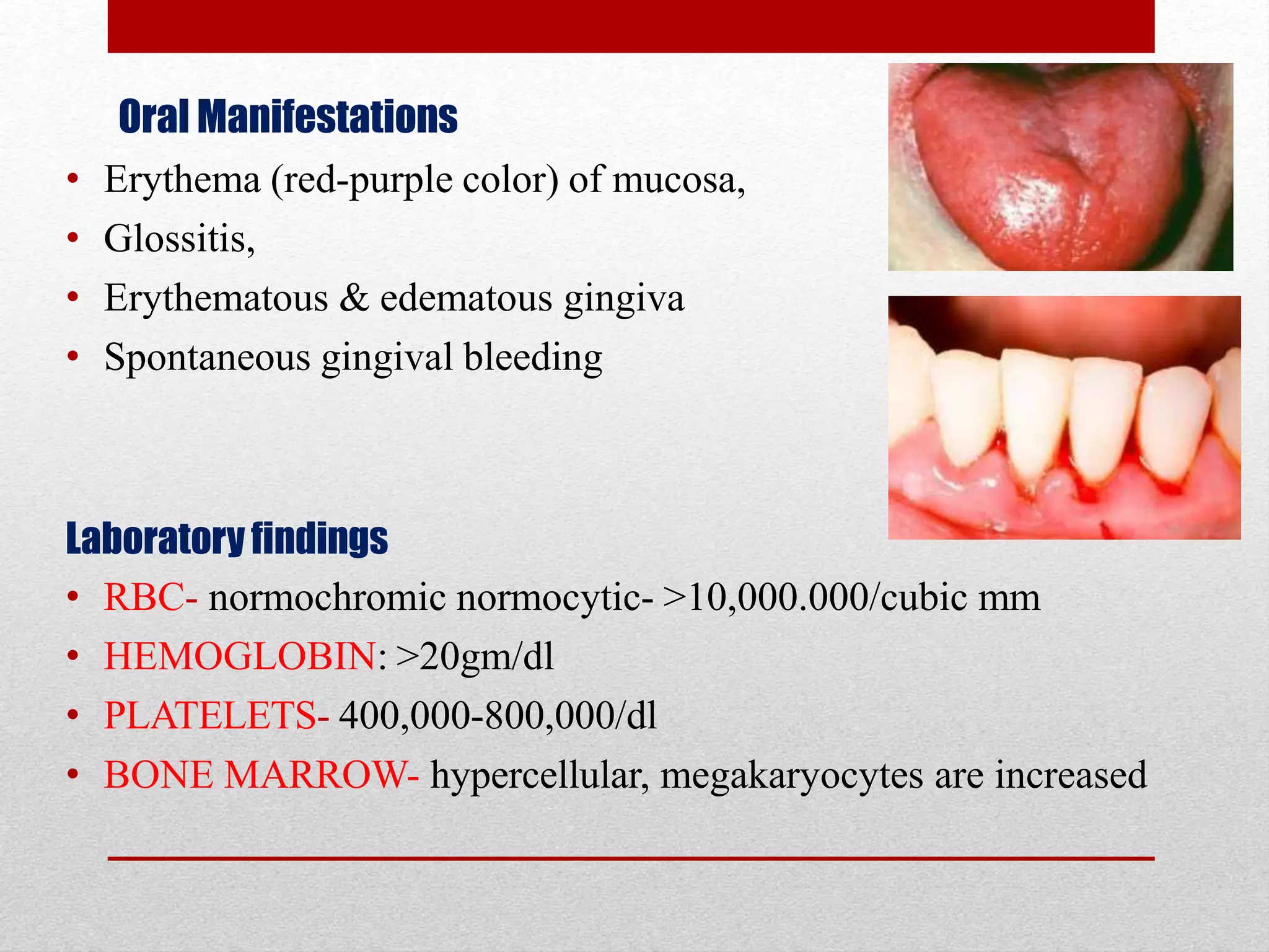 Bleeding and coagulation disorders.pptx