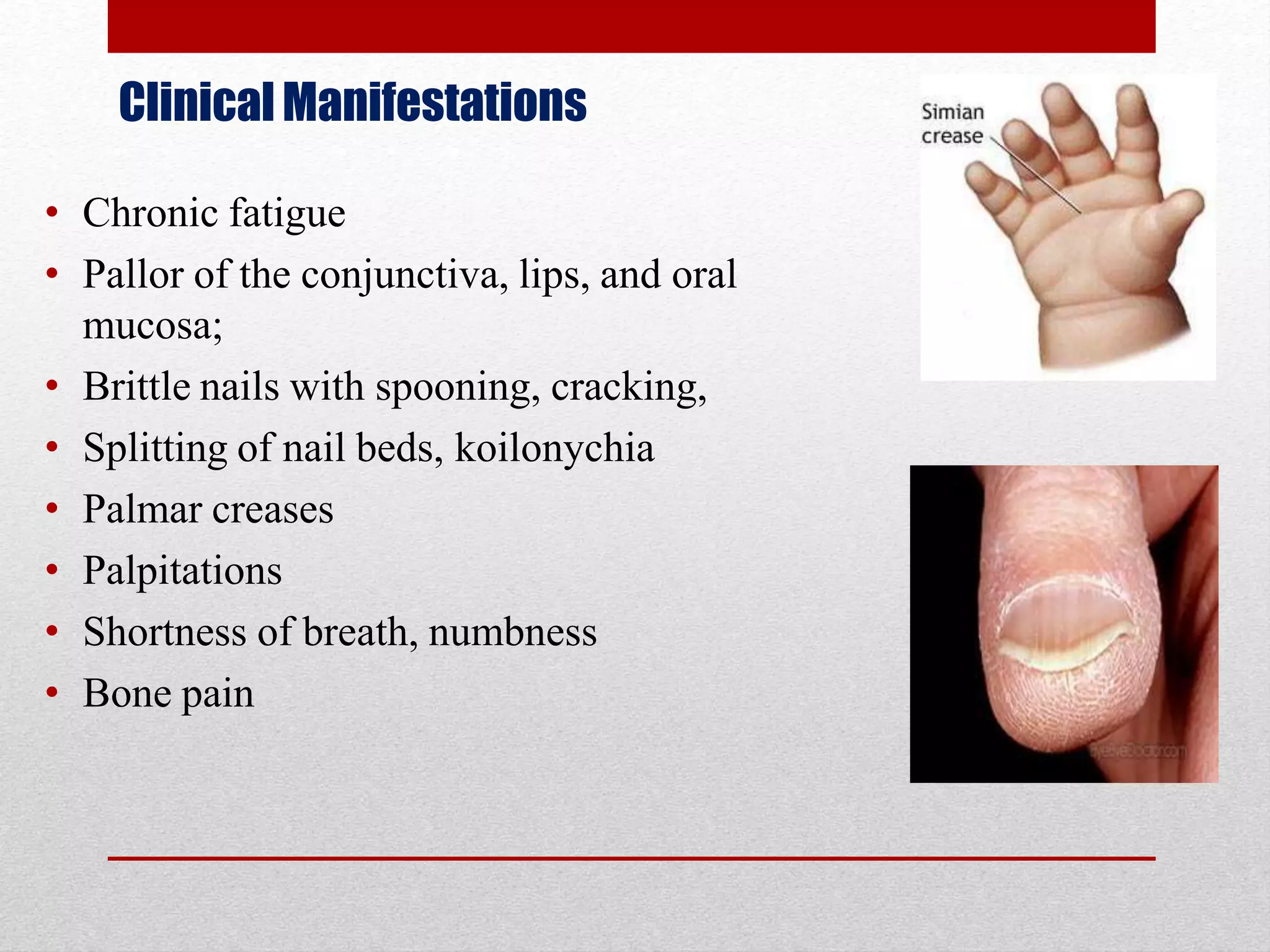 Bleeding and coagulation disorders.pptx