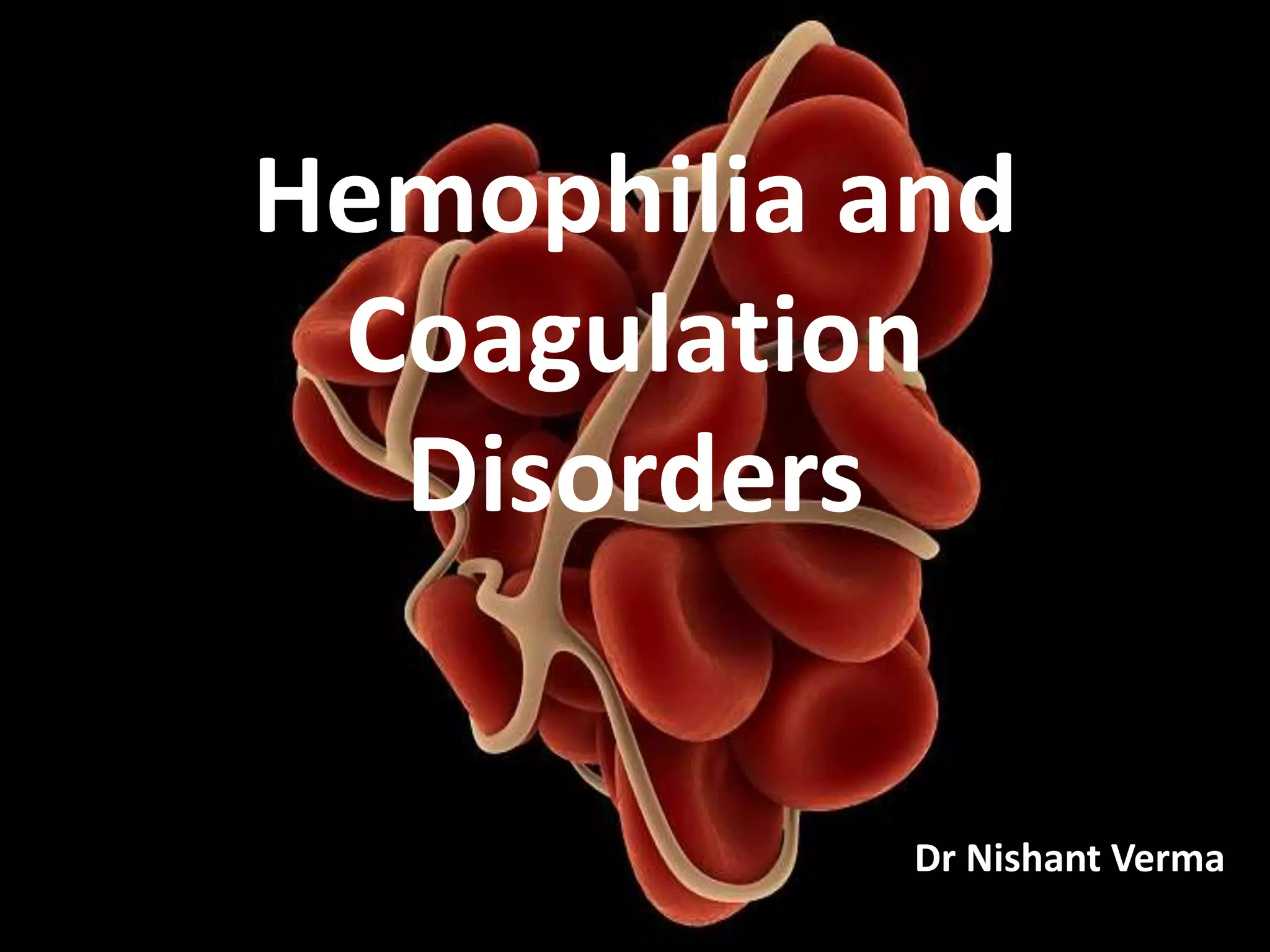 Bleeding_and_Coagulation_disorders_2015_2_lectures.pptx
