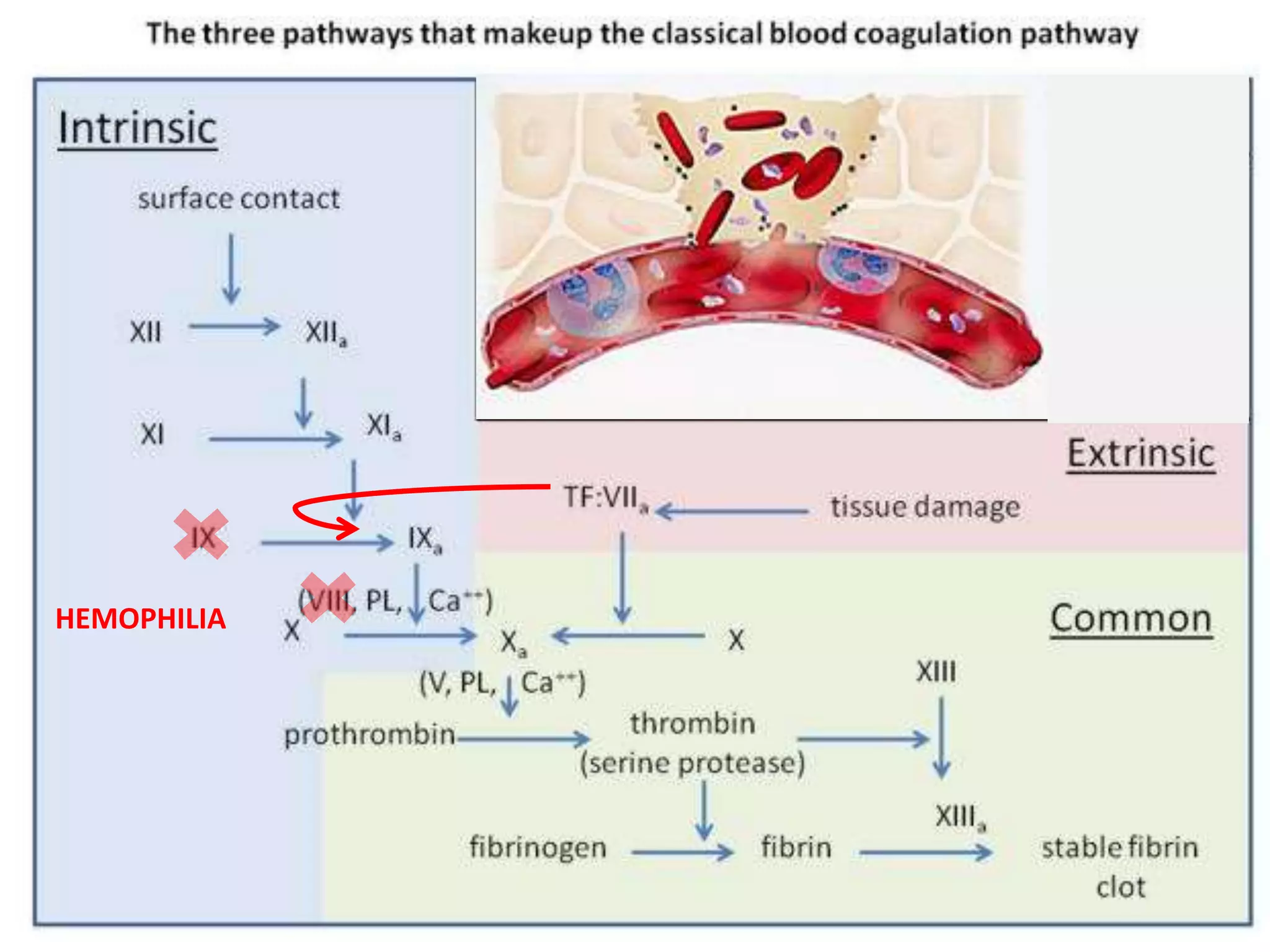 Bleeding_and_Coagulation_disorders_2015_2_lectures.pptx