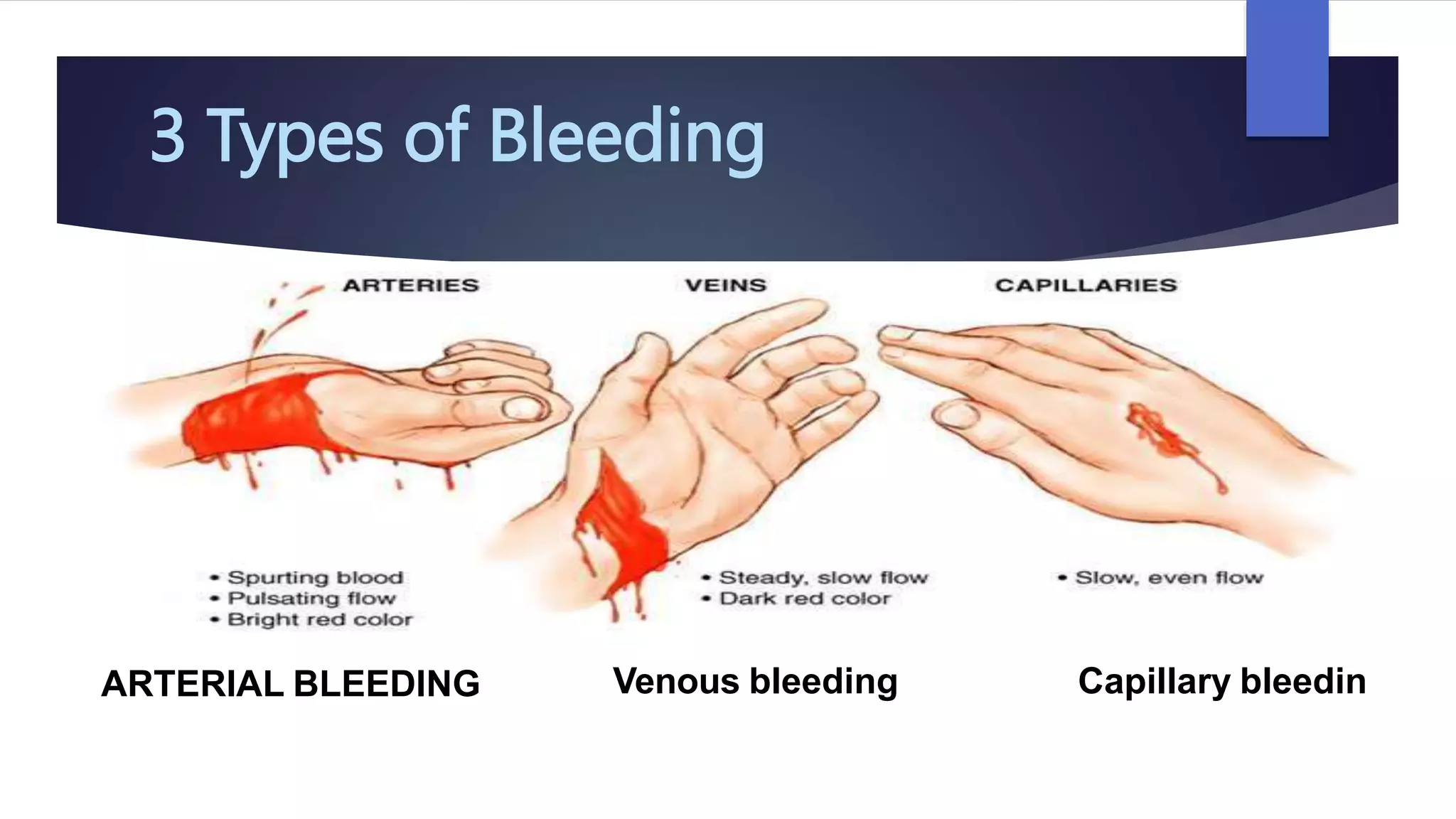BLEEDING AND FIRST AID FOR BLEEDING.pptx