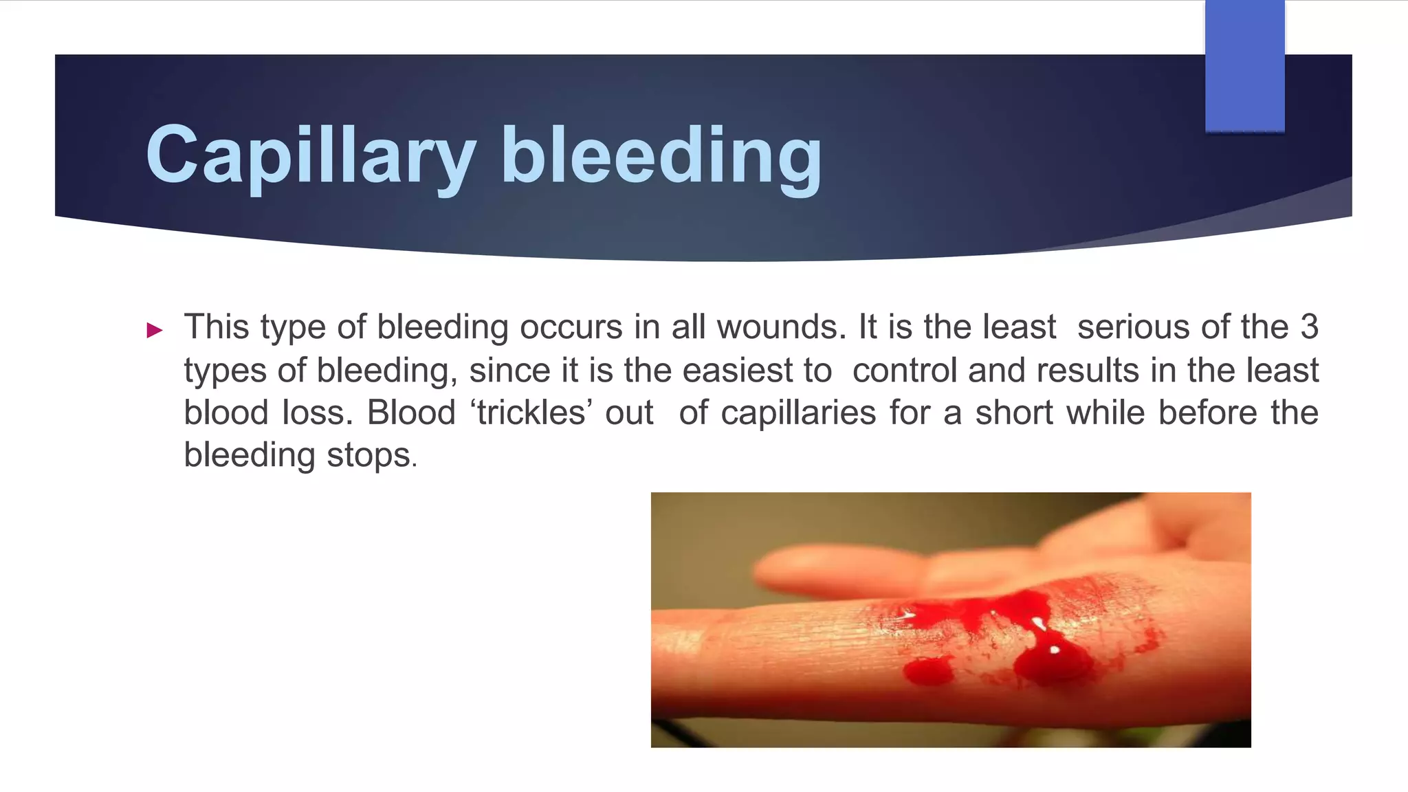 BLEEDING AND FIRST AID FOR BLEEDING.pptx