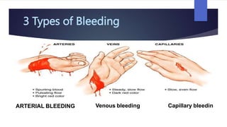 BLEEDING AND FIRST AID FOR BLEEDING.pptx