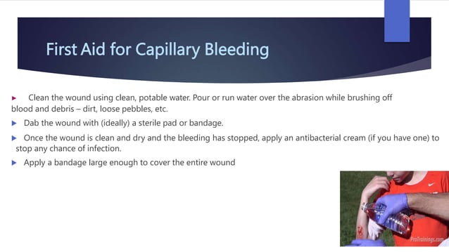 BLEEDING AND FIRST AID FOR BLEEDING.pptx | First Aid | Injuries