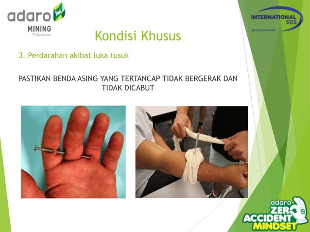 Bleeding control.pptx