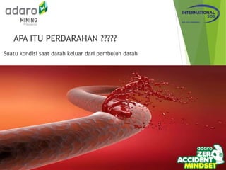 Bleeding control.pptx
