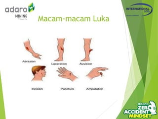 Bleeding control.pptx