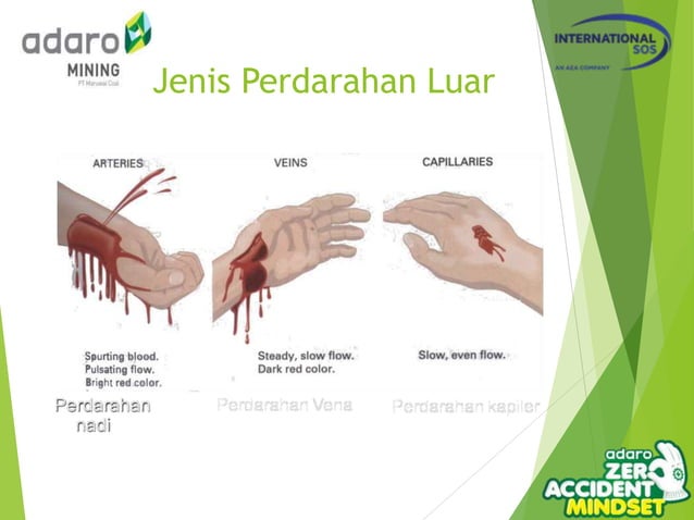 Bleeding control.pptx