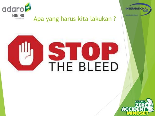 Bleeding Control Pptx