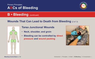 Bleeding Control Basic - Jim Persons | PDF