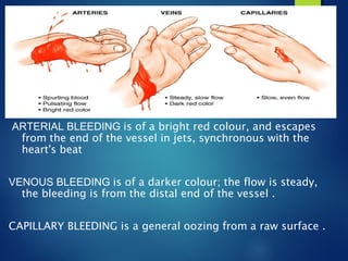 Bleeding control mit | PPT
