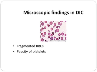 Hemorrhagic diathesis 2 | PPTX