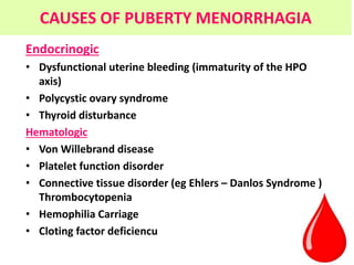 Menorrhagia Causes